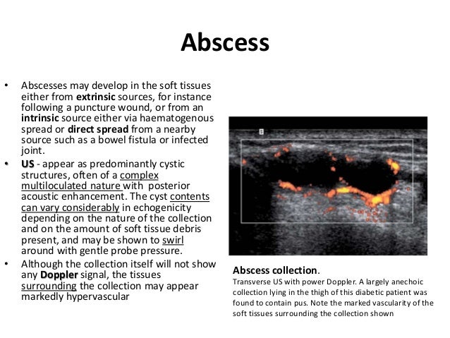 Imaging of Soft tissue pathology