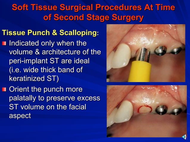 Soft tissue procedures | PDF