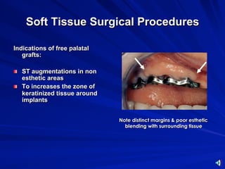 Soft tissue procedures | PDF
