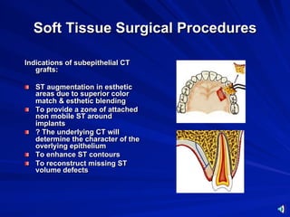 Soft tissue procedures | PDF