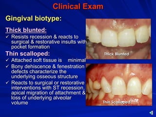Soft tissue procedures | PDF