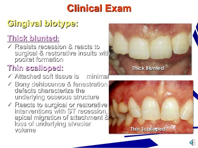 Soft tissue procedures