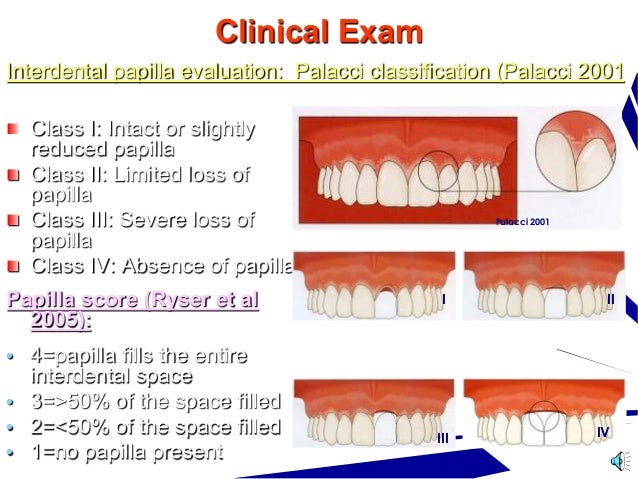 Soft tissue procedures
