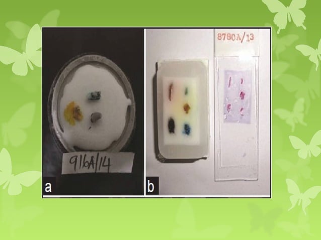 Soft tissue processing | PPT