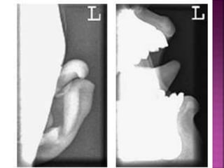 SOFT TISSUE RADIOGRAPHY By VIRENDRA KUMAR MAURYA | PPTX