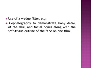 SOFT TISSUE RADIOGRAPHY By VIRENDRA KUMAR MAURYA | PPTX