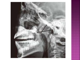 soft tissue radiography By VIRENDRA KUMAR MAURYA | PPTX