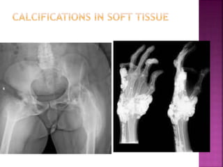 soft tissue radiography By VIRENDRA KUMAR MAURYA | PPTX