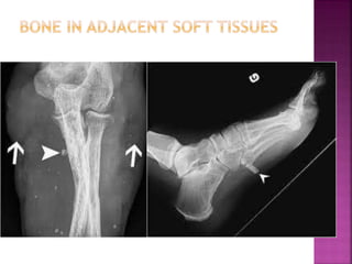 soft tissue radiography By VIRENDRA KUMAR MAURYA | PPTX