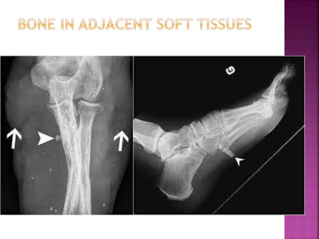 soft tissue radiography By VIRENDRA KUMAR MAURYA | PPTX