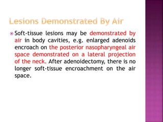 soft tissue radiography By VIRENDRA KUMAR MAURYA | PPTX