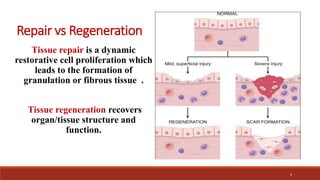 Dental Soft tissue regeneration | PPTX