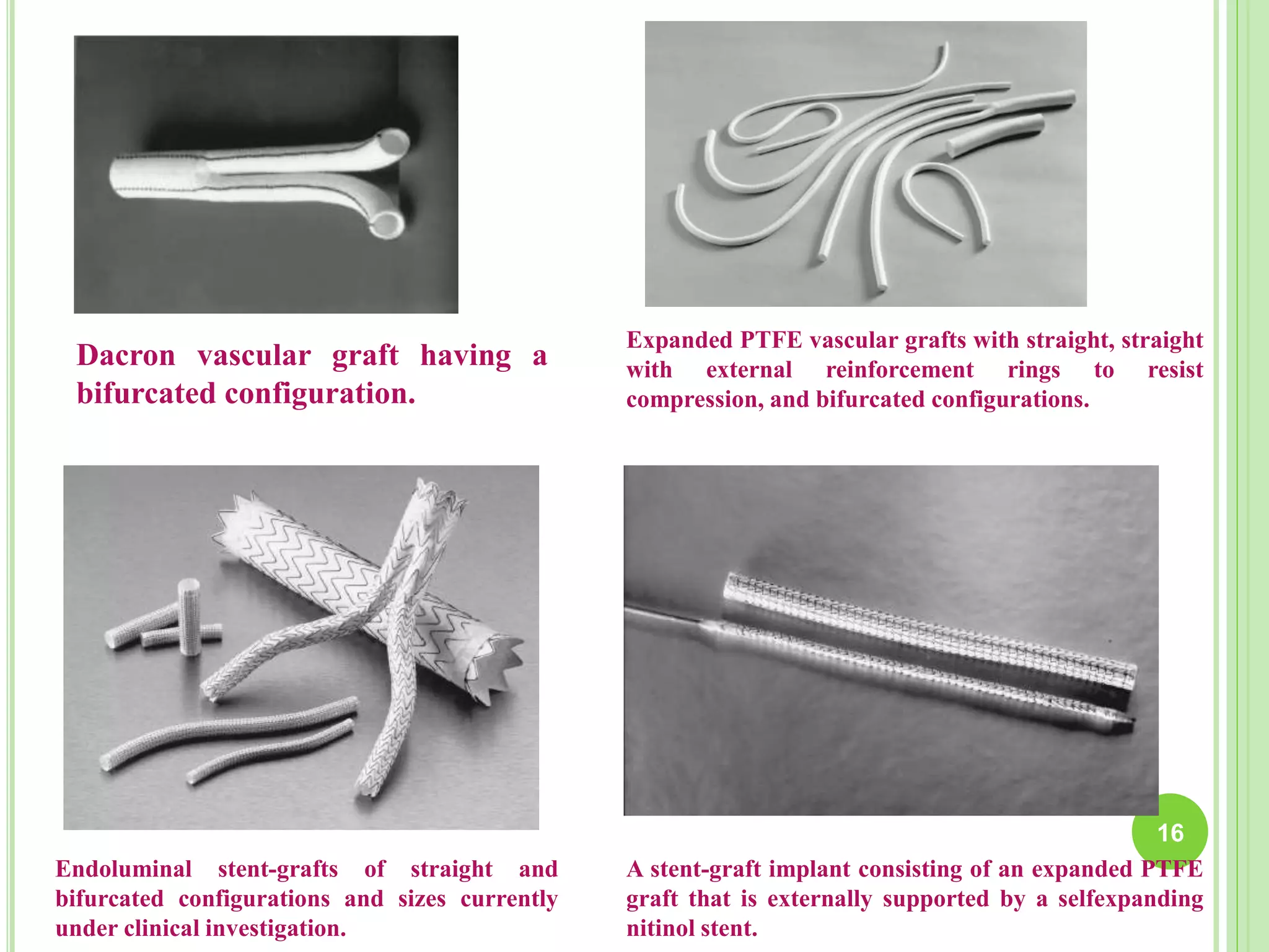 Soft tissue replacement | PPTX