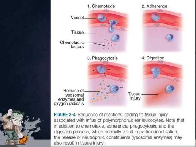 Soft tissue response and healing in omfs | PPTX | Death, Injury, or ...