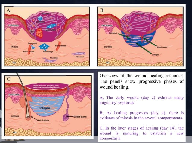 Soft tissue response and healing in omfs | PPTX | Death, Injury, or ...