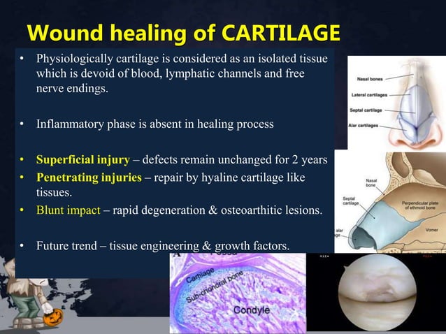 Soft tissue response and healing in omfs | PPTX | Death, Injury, or ...