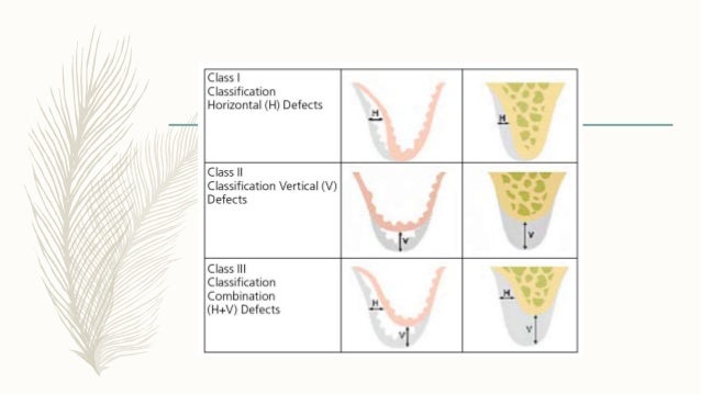 Soft tissue ridge augmentation