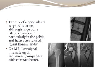 Soft tissue s | PPTX