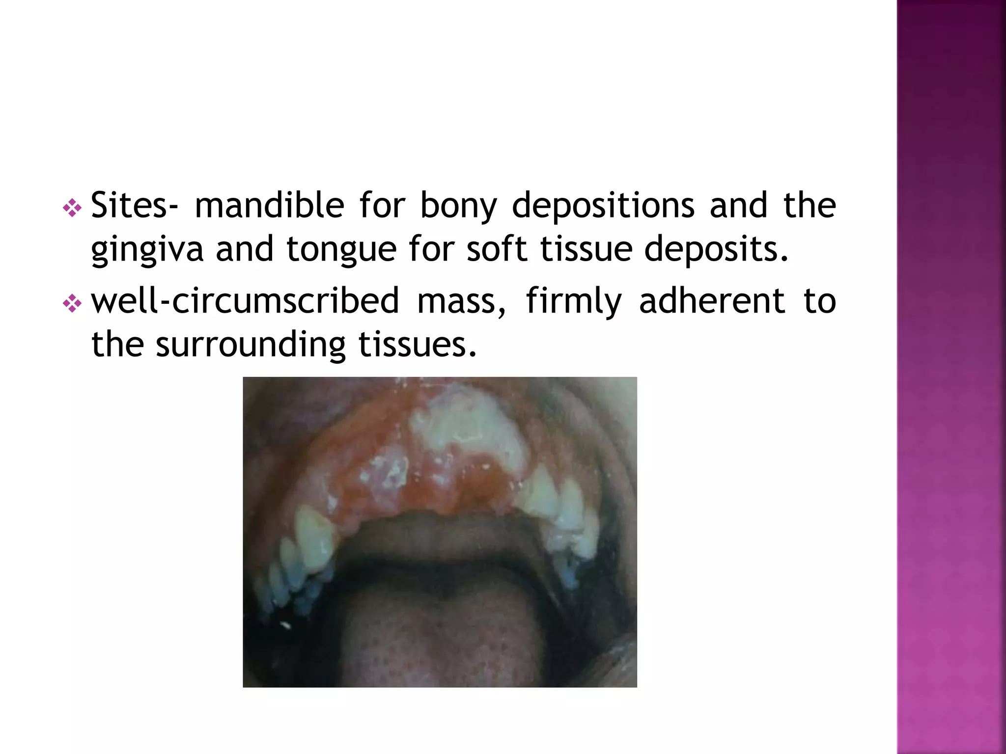 SOFT TISSUE SARCOMAS.pptx