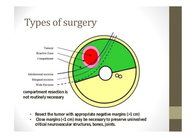 Soft tissue sarcoma (sts)