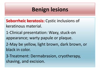 Soft tissues tumors. general surgerypptx | PPTX