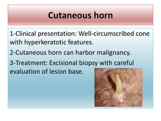 Soft tissues tumors. general surgerypptx | PPTX