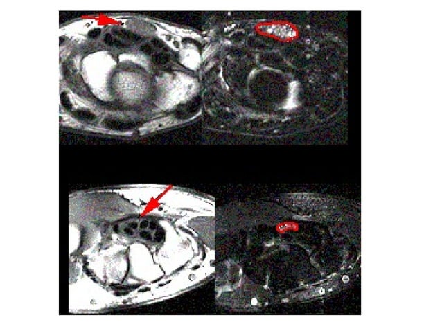 Soft tissue swelling | PPT | Bone and Joint Conditions | Diseases and ...