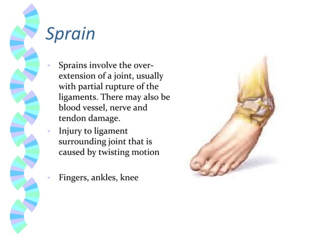 SoftTissue Trauma and causes sign symptoms | PPT