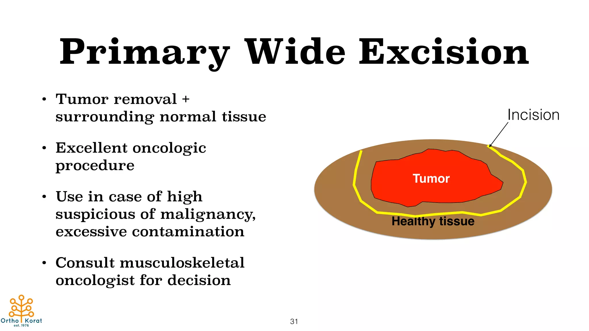 Approach to Soft Tissue Tumor in Upper Extremity | PDF