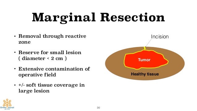 Approach to Soft Tissue Tumor in Upper Extremity