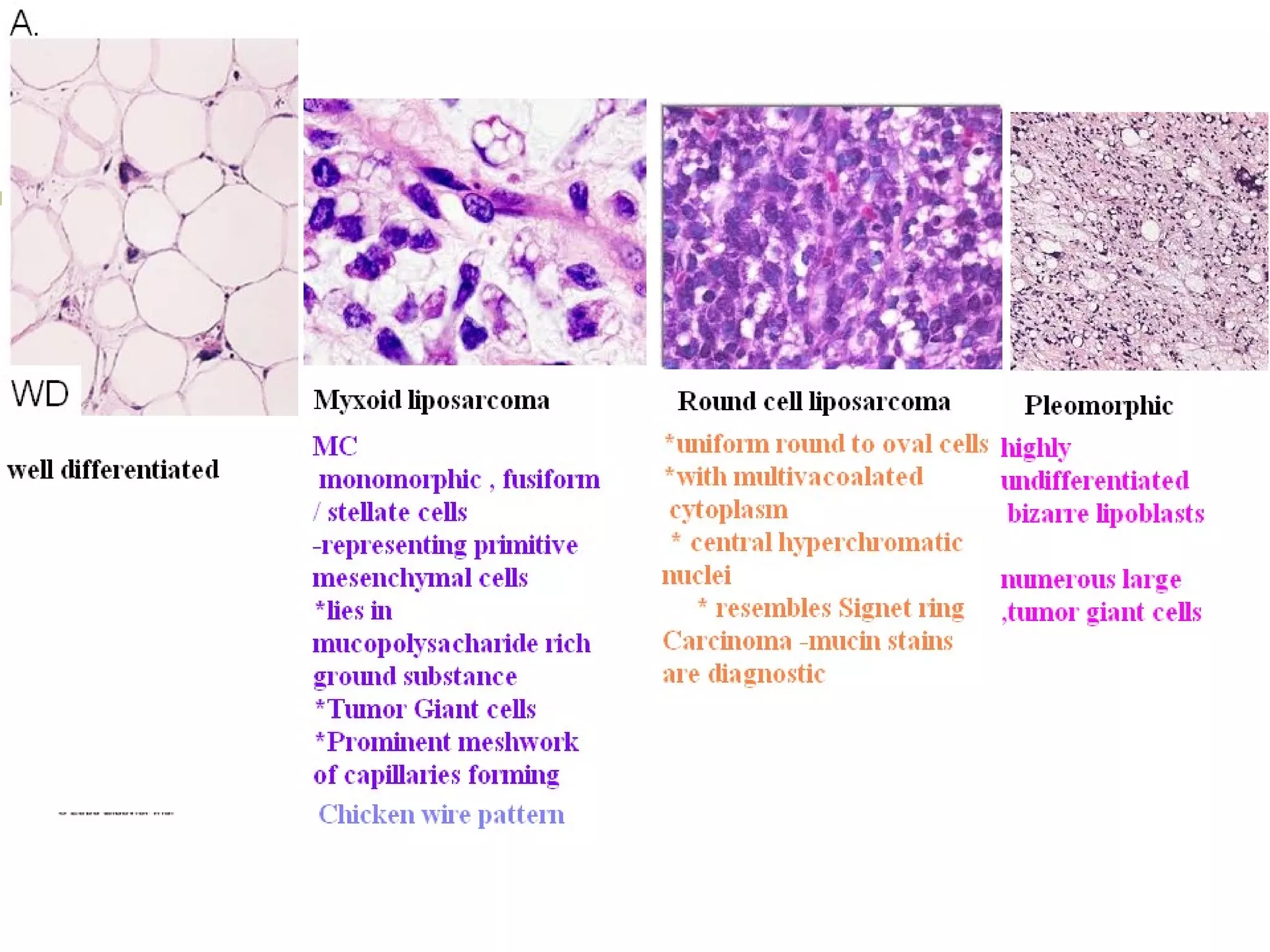 Soft tissue tumors | PPT