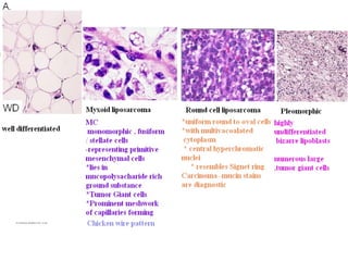 Soft tissue tumors | PPT