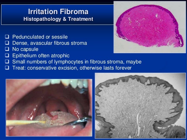 Soft tissue tumors 1 2007