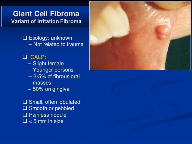 Soft tissue tumors 1 2007
