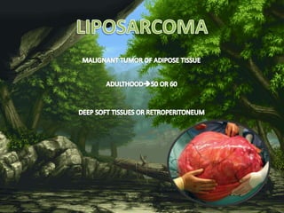 Soft tissue tumors | PPT