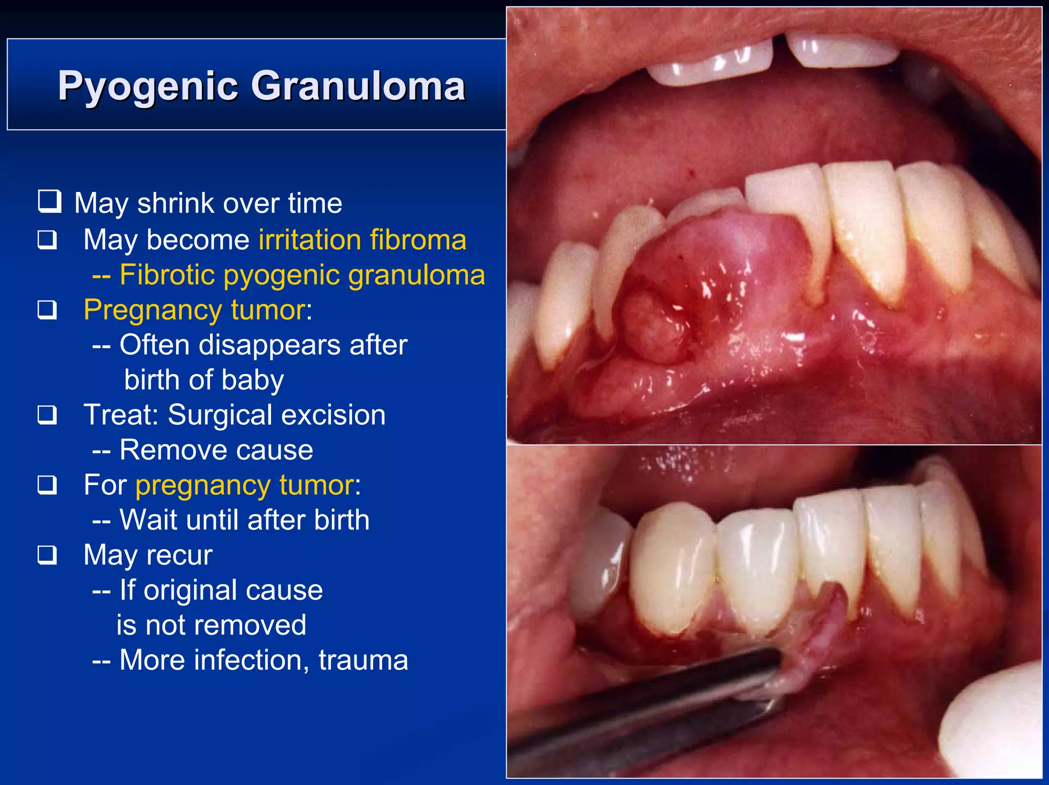 Soft tissue tumors 2 2007 | PDF