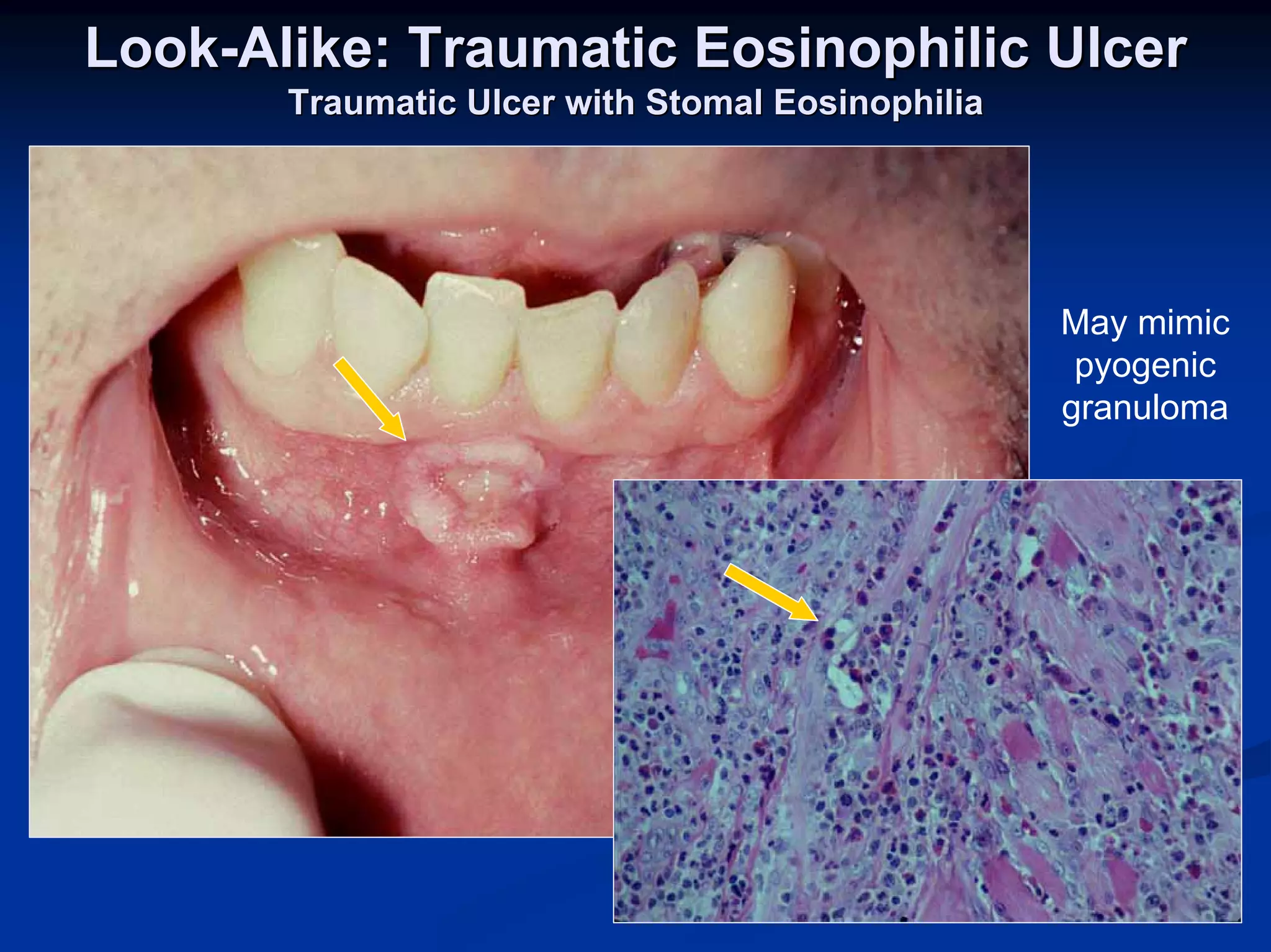 Soft tissue tumors 2 2007 | PDF