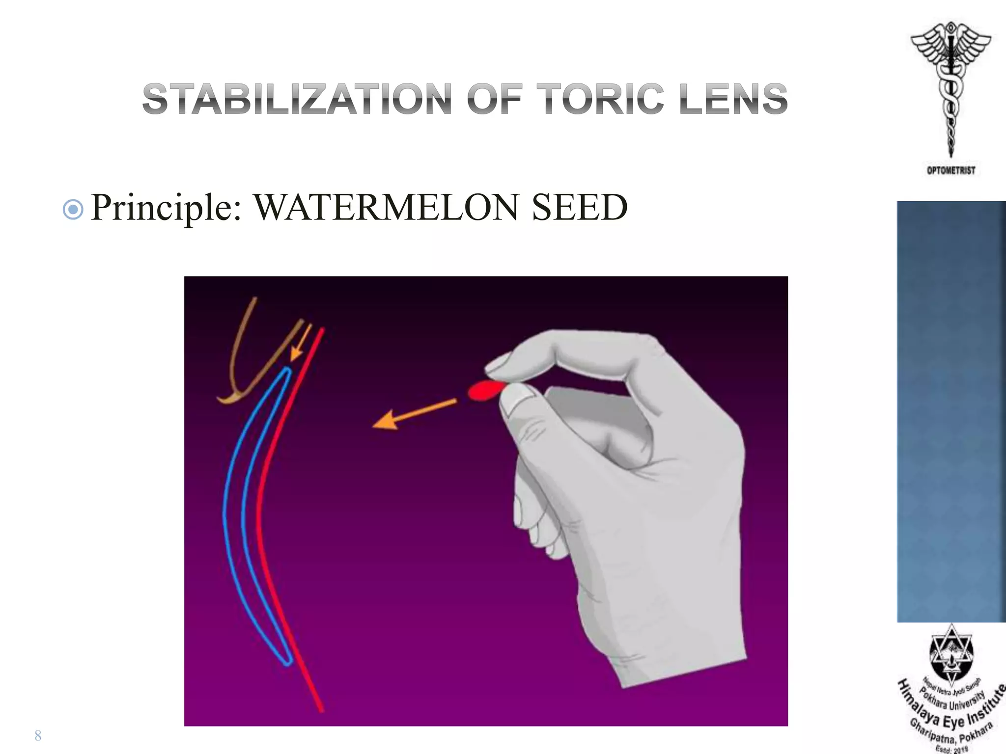 SOFT TORIC CONTACT LENS FITTING.pptx