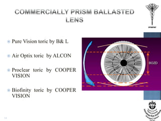 SOFT TORIC CONTACT LENS FITTING.pptx