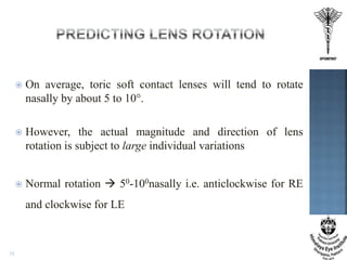 SOFT TORIC CONTACT LENS FITTING.pptx