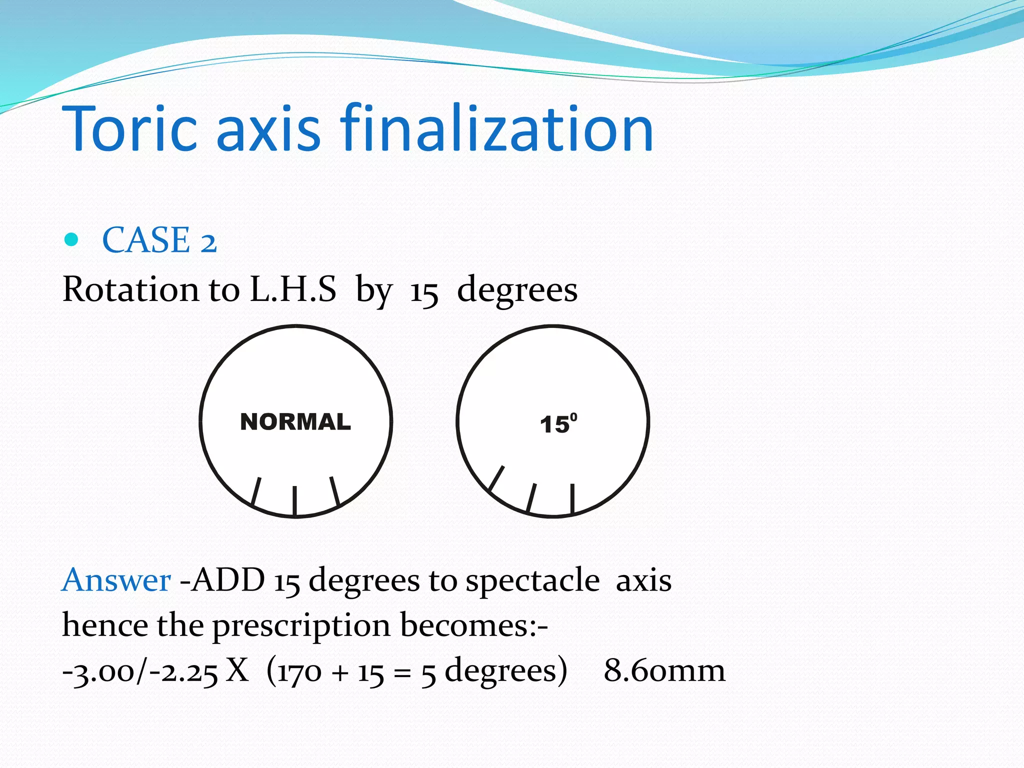 Soft toric Contact Lens | PPTX