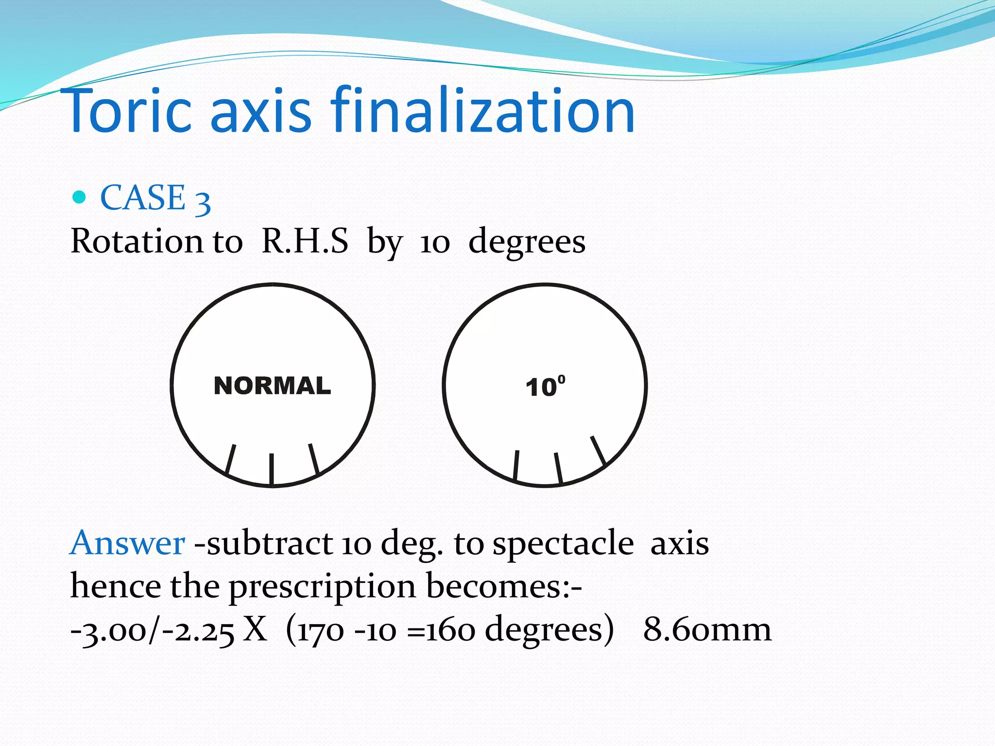 Soft toric Contact Lens | PPTX
