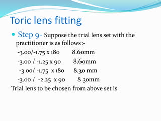 Soft toric Contact Lens | PPTX