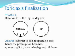 Soft toric Contact Lens | PPT