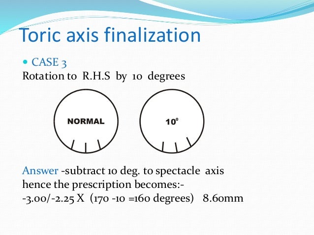 Soft toric Contact Lens