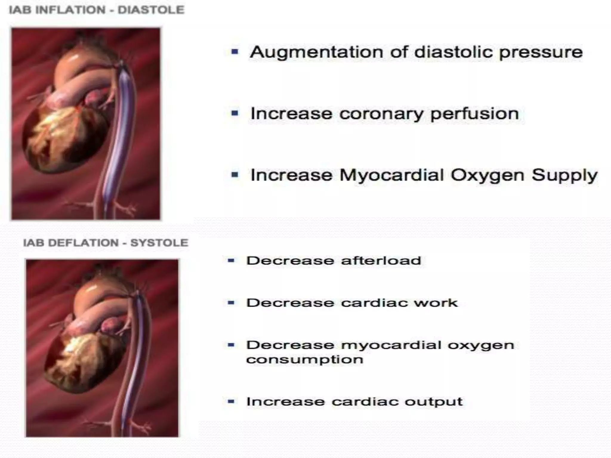 IABP- intra Aortic Balloon Pump | PPTX