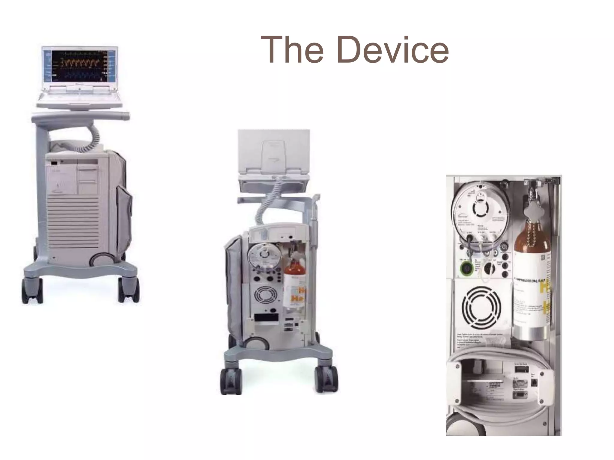 IABP- intra Aortic Balloon Pump | PPTX