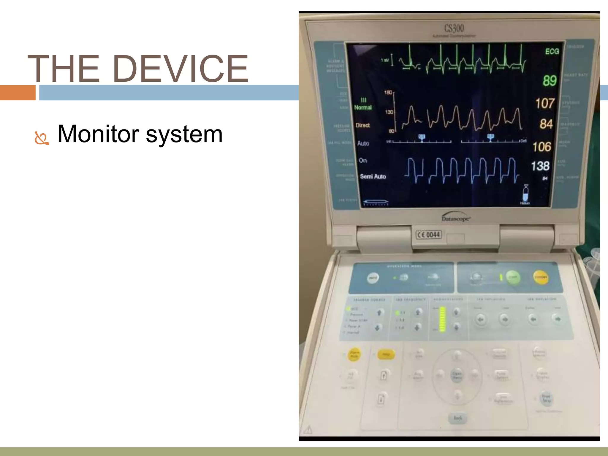 IABP- intra Aortic Balloon Pump | PPTX