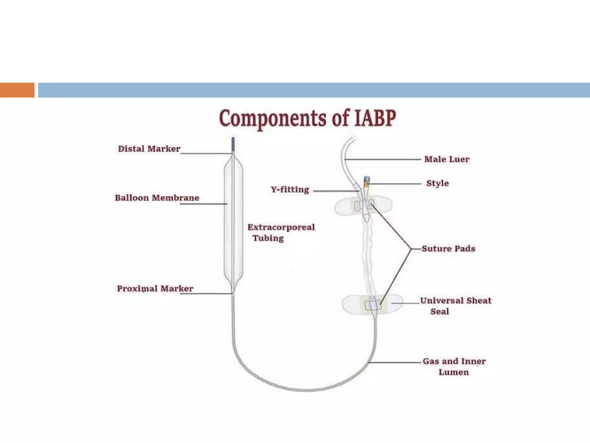 IABP- intra Aortic Balloon Pump | PPTX