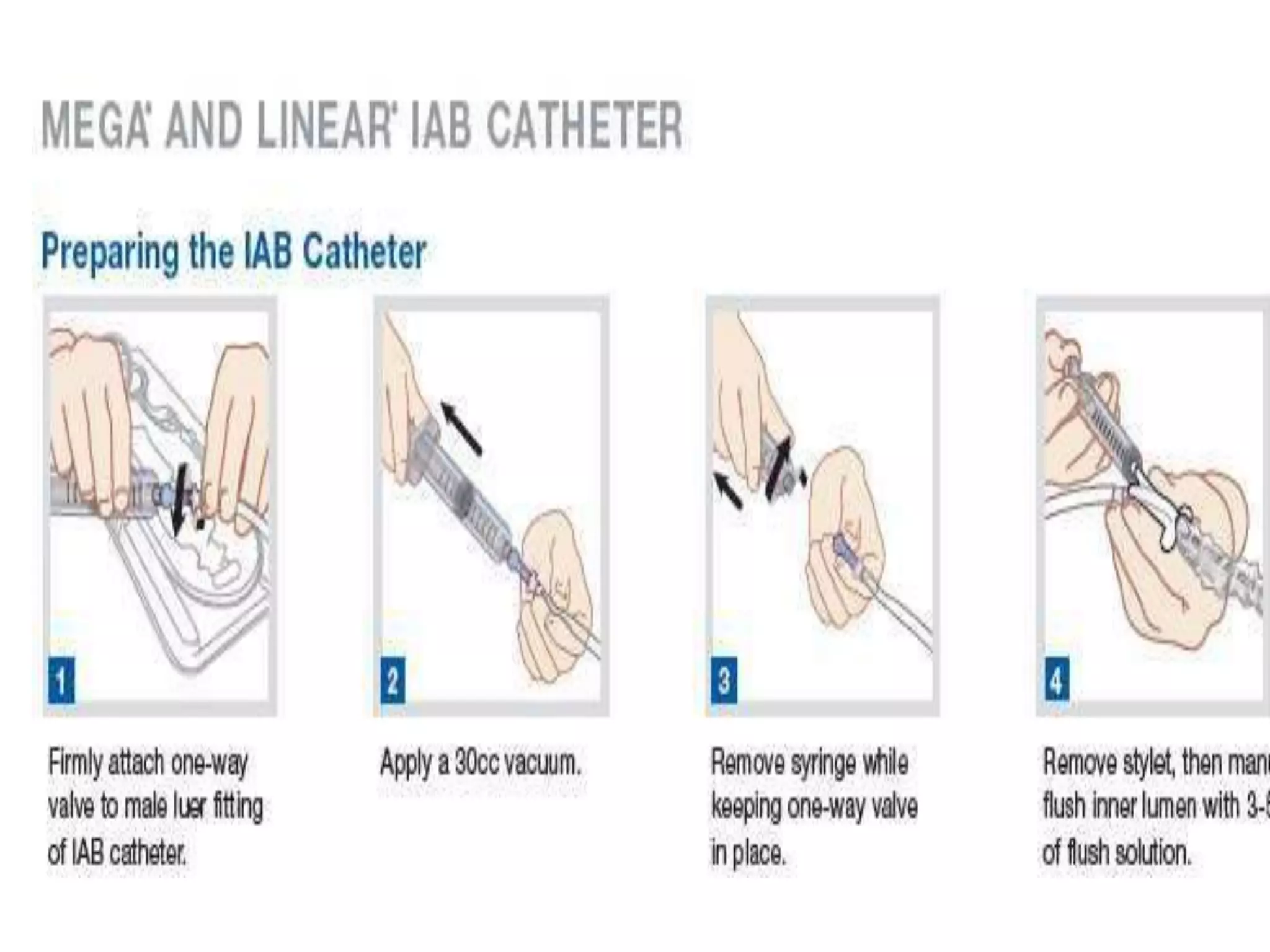 IABP- intra Aortic Balloon Pump | PPTX